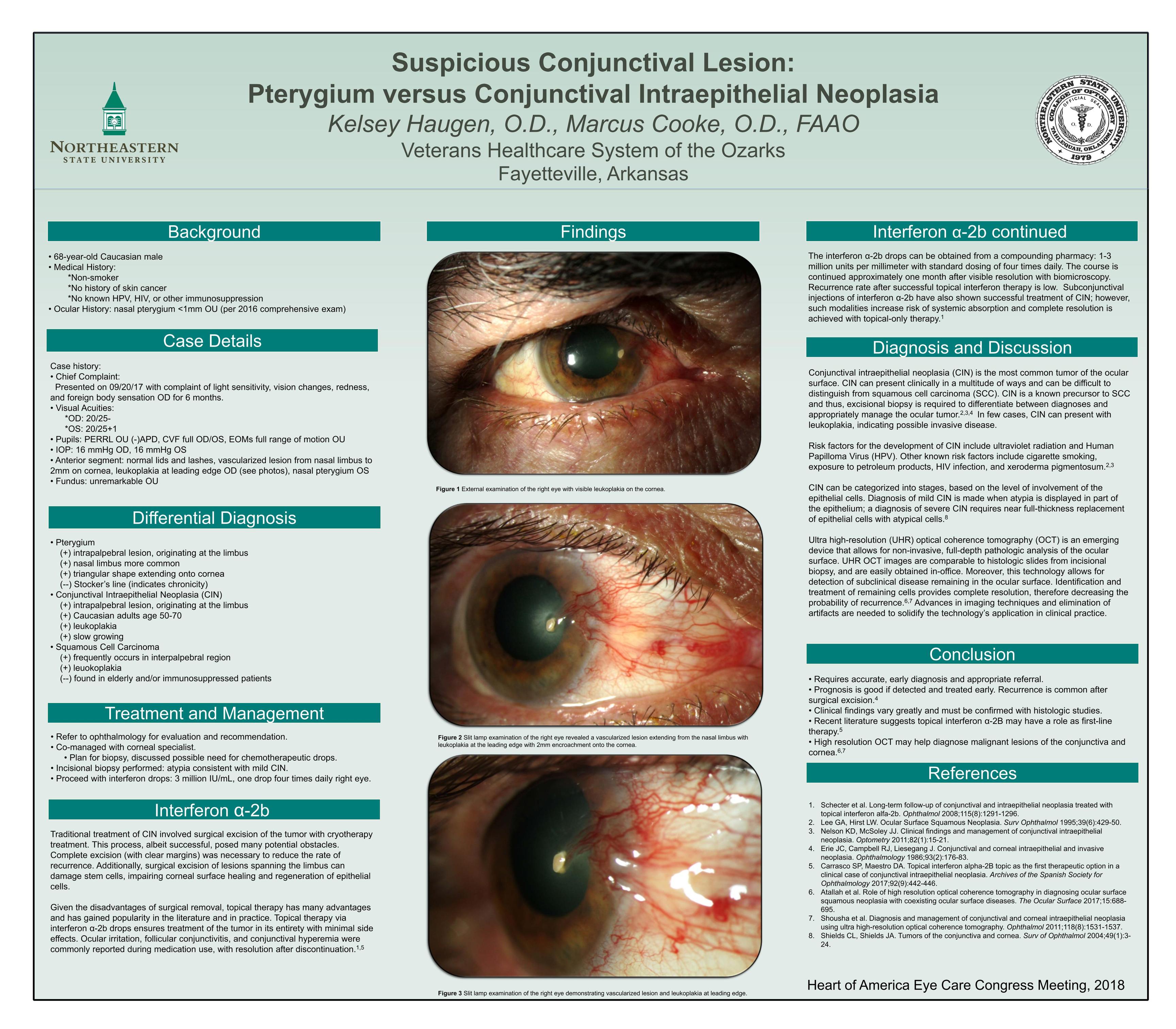 Heart of America Eye Care Congress - 2018 Poster Award Winners